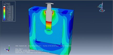 Bio-Mechanical Abaqus Simulation Full Package - CAE Assistant
