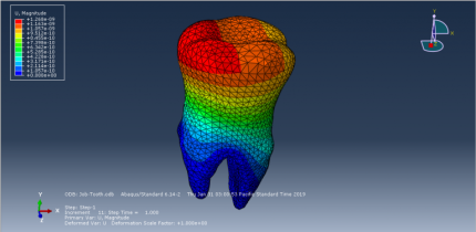Bio-Mechanical Abaqus Simulation Full Package - CAE Assistant