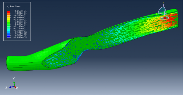 Bio-Mechanical Abaqus Simulation Full Package - CAE Assistant