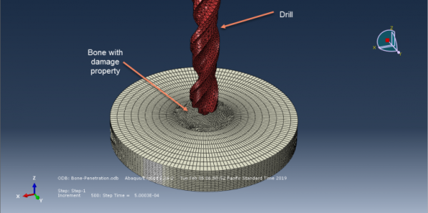 Bio-Mechanical Abaqus Simulation Full Package - CAE Assistant