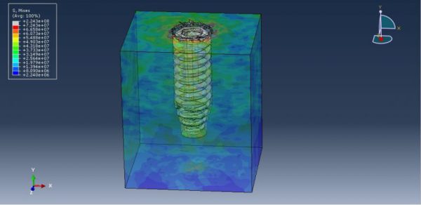 Bio-Mechanical Abaqus Simulation Full Package - CAE Assistant